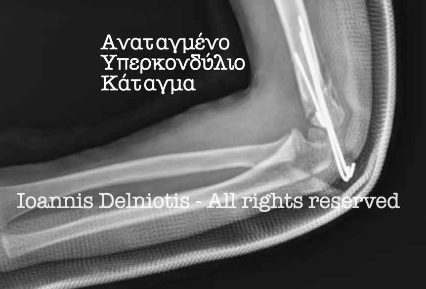 Υπερκονδύλιο κάταγμα αγκώνα σε παιδιά - Ιωάννης Δελνιώτης
