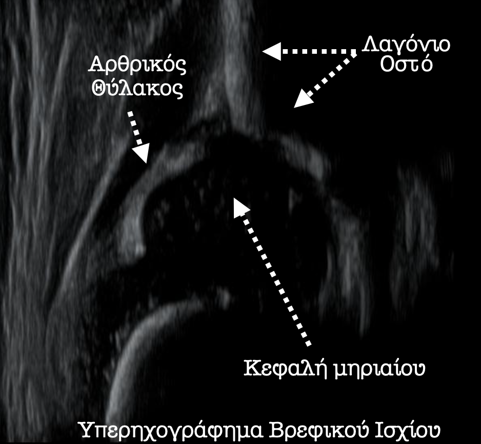 Παιδο-ορθοπαιδική εξέταση νεογνού - Ιωάννης Δελνιώτης